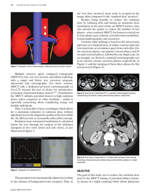 Feasibility of CT scan studies with triple split bolus intravenous c…
