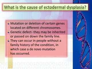 Ectodermal dysplasia | PPTX