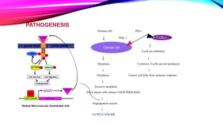 LUNG CANCER TREATMENT BY NIVOLUMAB | PPT