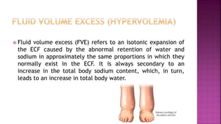 Fluid and Electrolyte Imbalance | PPTX