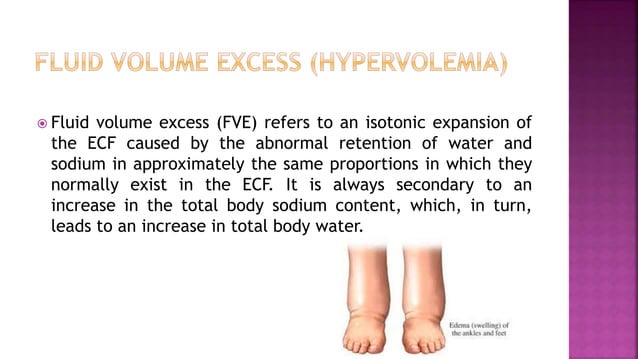 Fluid and Electrolyte Imbalance | PPTX | Blood Disorders | Diseases and ...