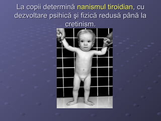 0glandeendocrine | PPT