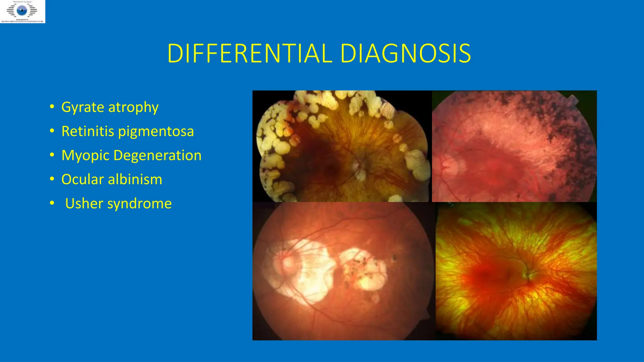 CHOROIDEREMIA presentation dhir hospital bhiwani.pptx