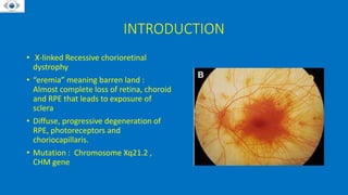 CHOROIDEREMIA presentation dhir hospital bhiwani.pptx