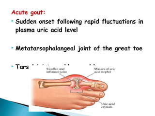 12.drugs used in rheumatoid arthritis and gout | PPT