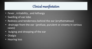 Mastoiditis - inflammation of mastoid bone | PPTX