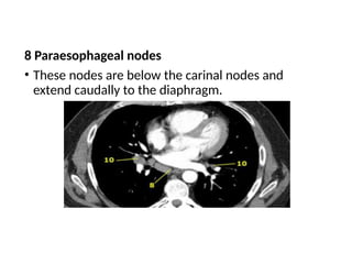 mediastinal lymph nodes anatomy (thorax) | PPTX