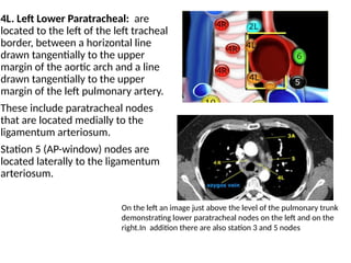 mediastinal lymph nodes anatomy (thorax) | PPTX