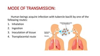 Pathophysiology and clinical management of tuberculosis | PPTX
