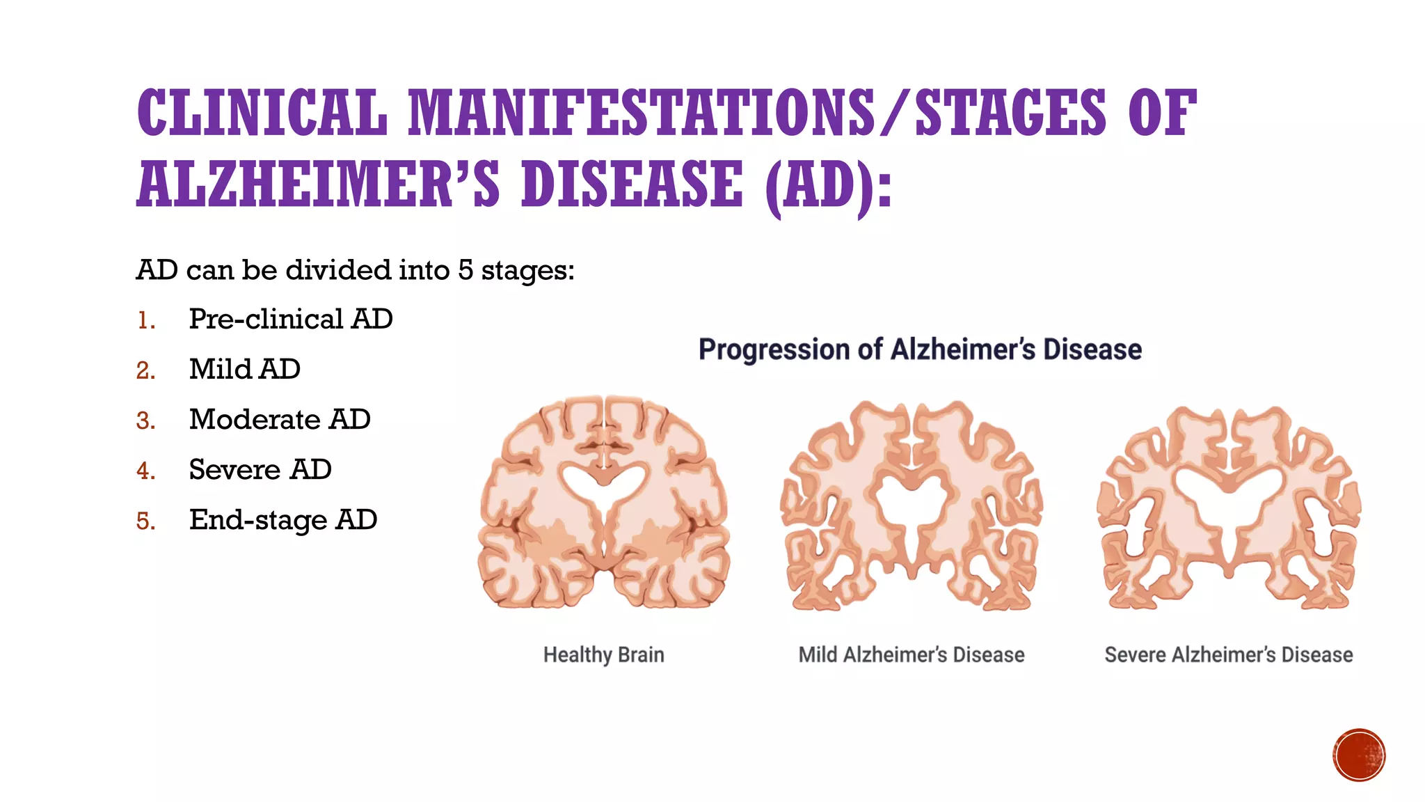 Pathophysiology and management of alzheimer's disease | PDF