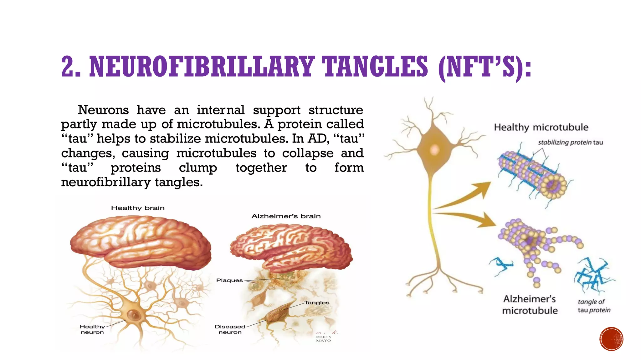 Pathophysiology and management of alzheimer's disease | PDF