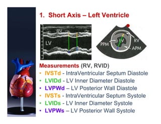 0PowerPoint- focused Echocardiography.pdf