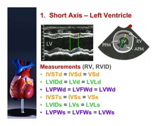 0PowerPoint- focused Echocardiography.pdf