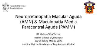 Neurorretinopatia Macular Media y Maculopatia Media Aguda | PPTX