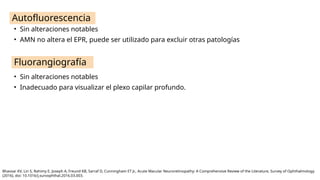 Neurorretinopatia Macular Media y Maculopatia Media Aguda | PPTX