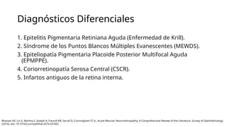 Neurorretinopatia Macular Media y Maculopatia Media Aguda | PPTX