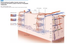 Neurorretinopatia Macular Media y Maculopatia Media Aguda | PPTX