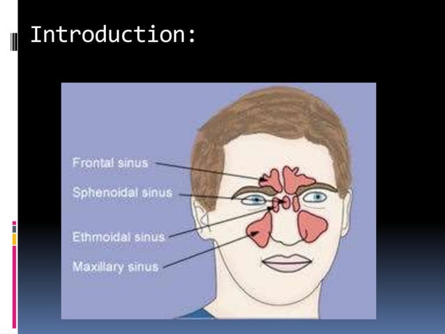 SEMINAR_ON_MAXILLARY_SINUS.ppt