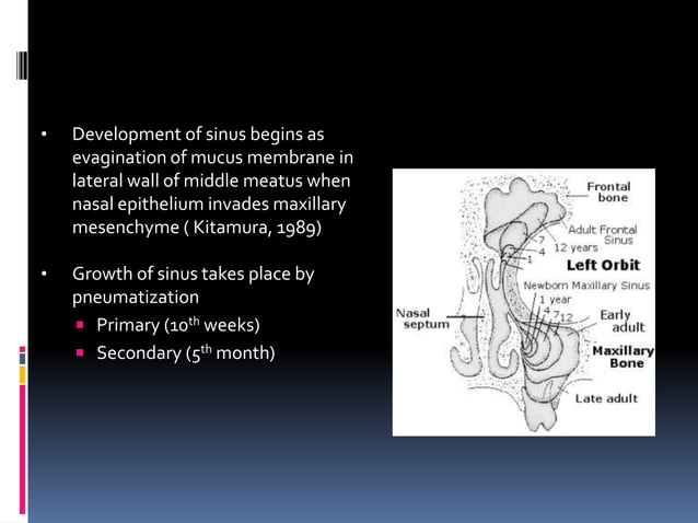 SEMINAR_ON_MAXILLARY_SINUS.ppt
