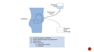 Renal dialysis or renal replacement therapy | PPTX