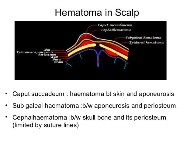scalp rishi naihs nepal