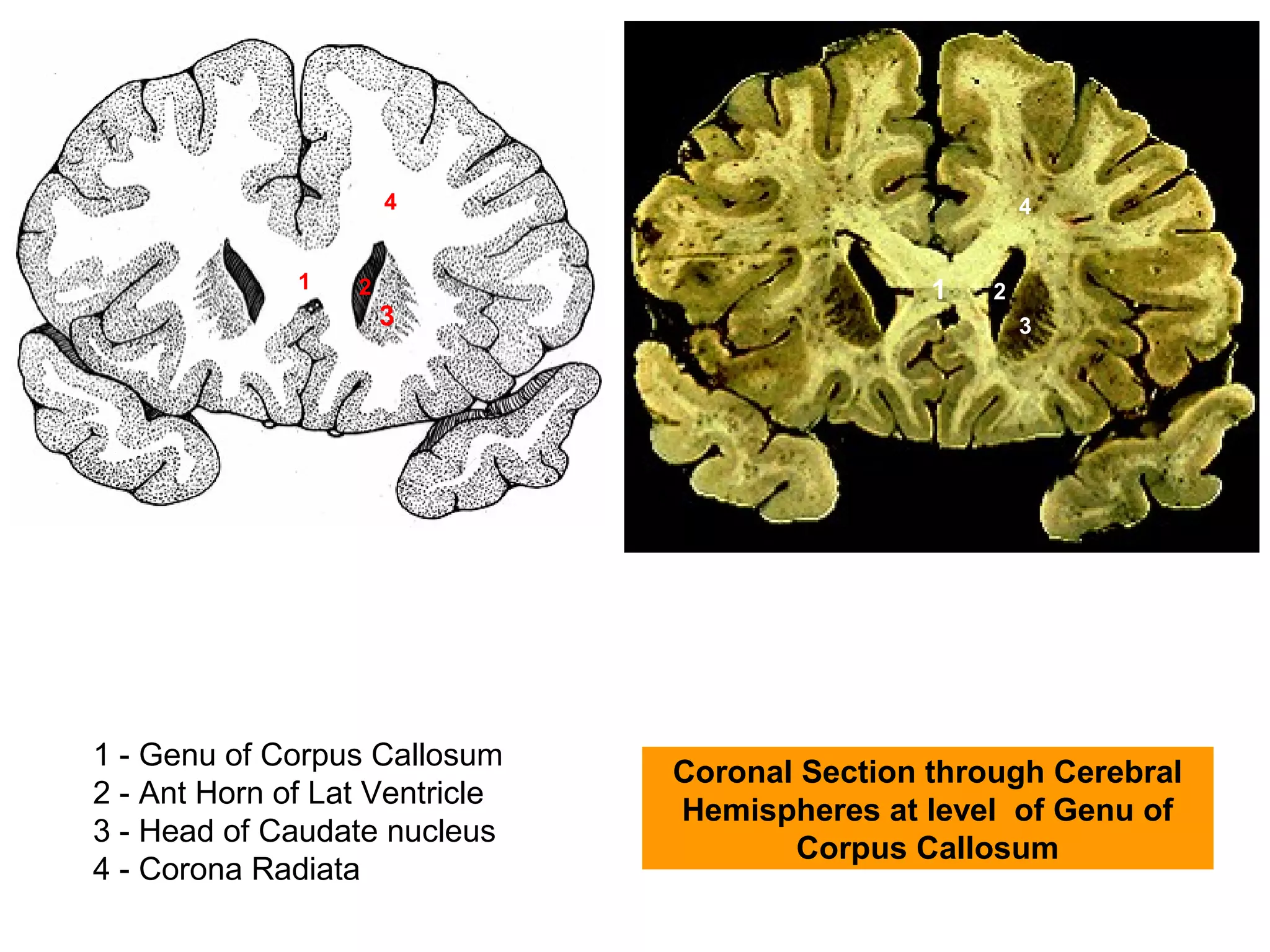 cerebrum sections for revision | PPT