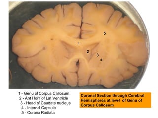cerebrum sections for revision | PPT