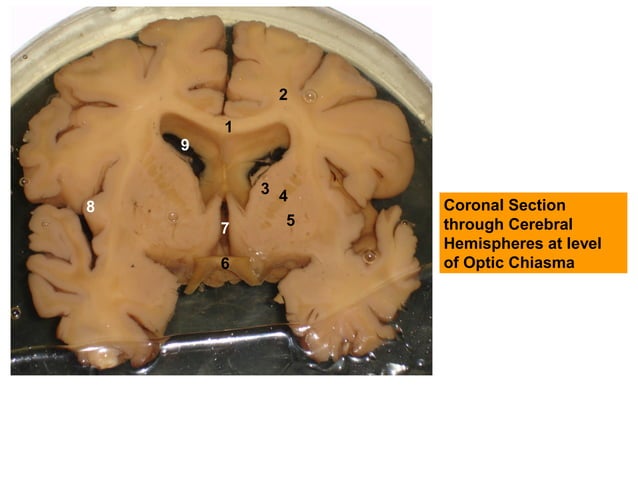 cerebrum sections for revision | PPT | Brain and Nervous System ...