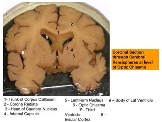 cerebrum sections for revision | PPT