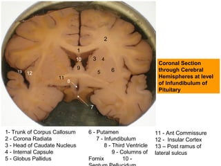cerebrum sections for revision | PPT