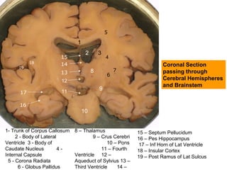 cerebrum sections for revision | PPT