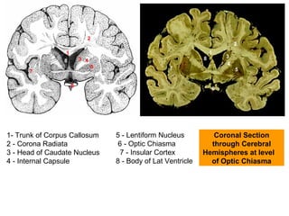 cerebrum sections for revision | PPT
