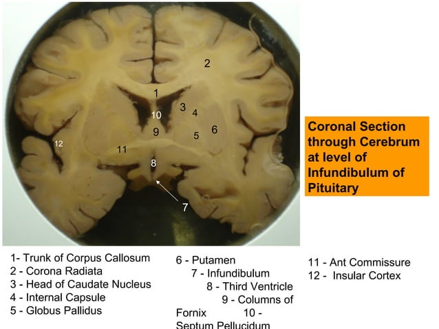 cerebrum sections for revision | PPT | Brain and Nervous System ...