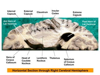 cerebrum sections for revision | PPT