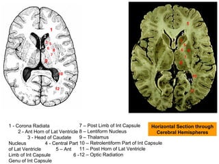 cerebrum sections for revision | PPT