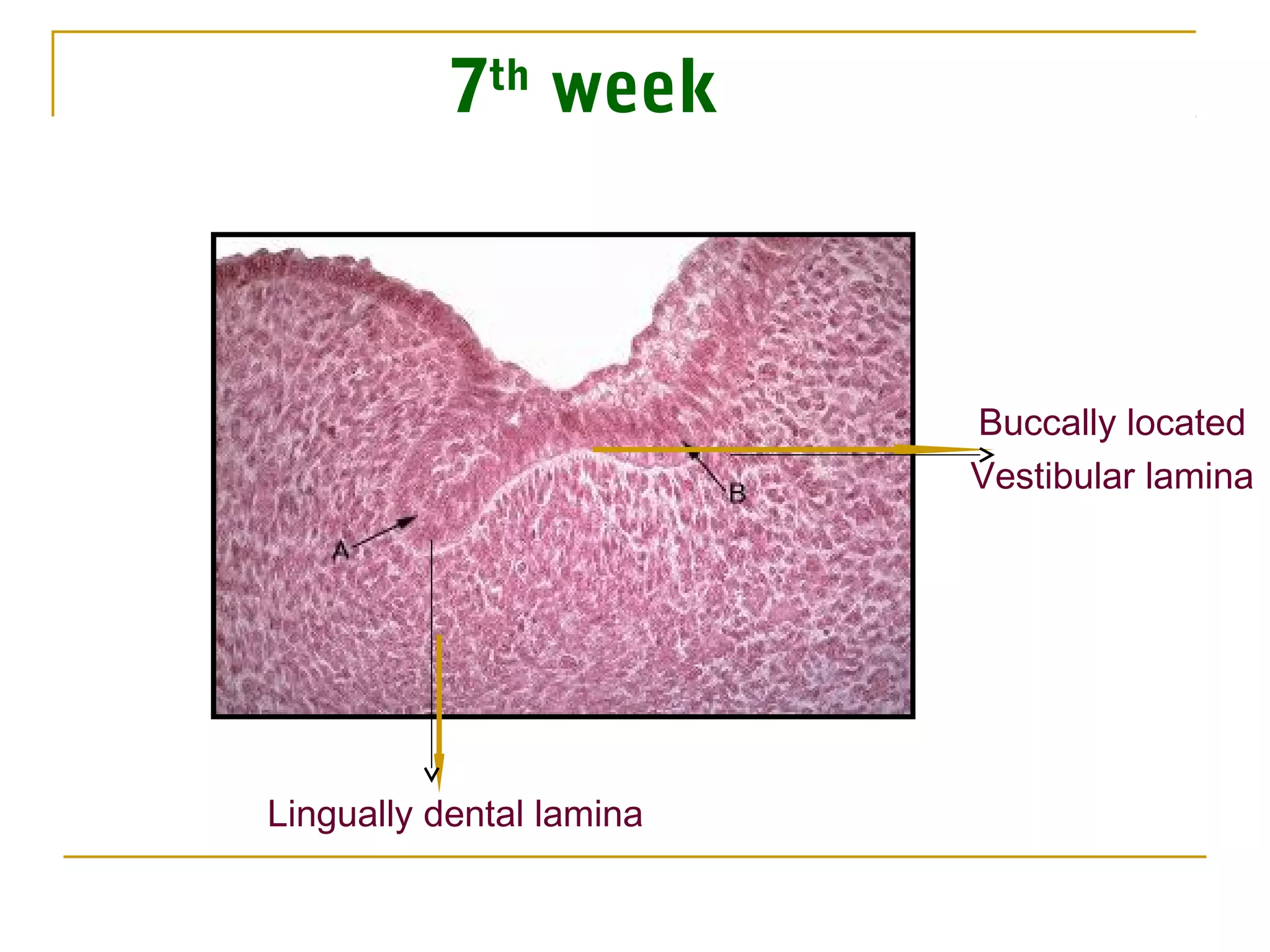 (dental basic seminar)Development of tooth with basic embryology ...
