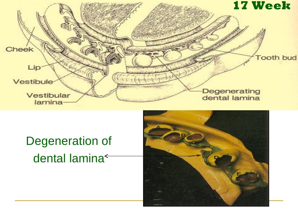 (dental basic seminar)Development of tooth with basic embryology (p…