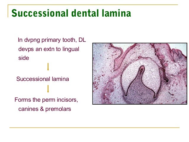 (dental basic seminar)Development of tooth with basic embryology (p…