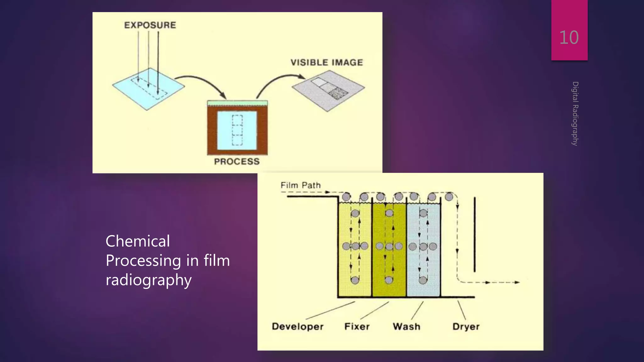 Digital imaging IN DENTISTRY | PPTX