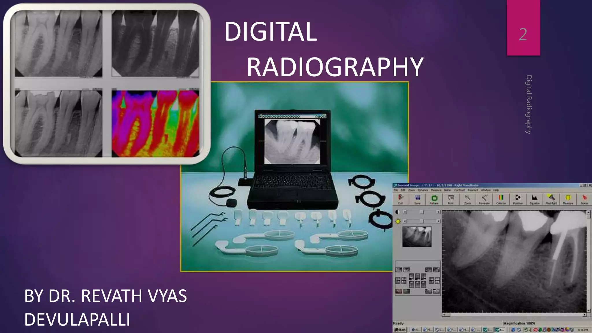 Digital imaging IN DENTISTRY | PPTX