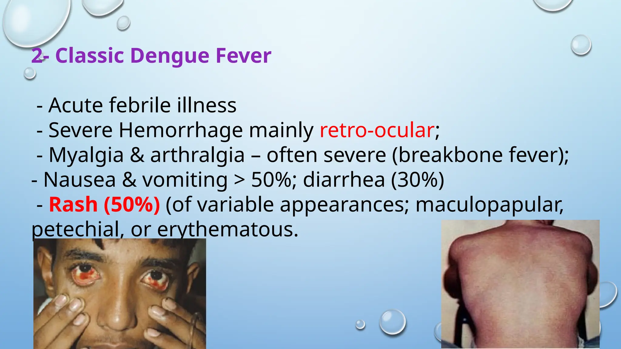 0 Viral Hemorrhagic Fever GROUP 29999999999999999999.pptx