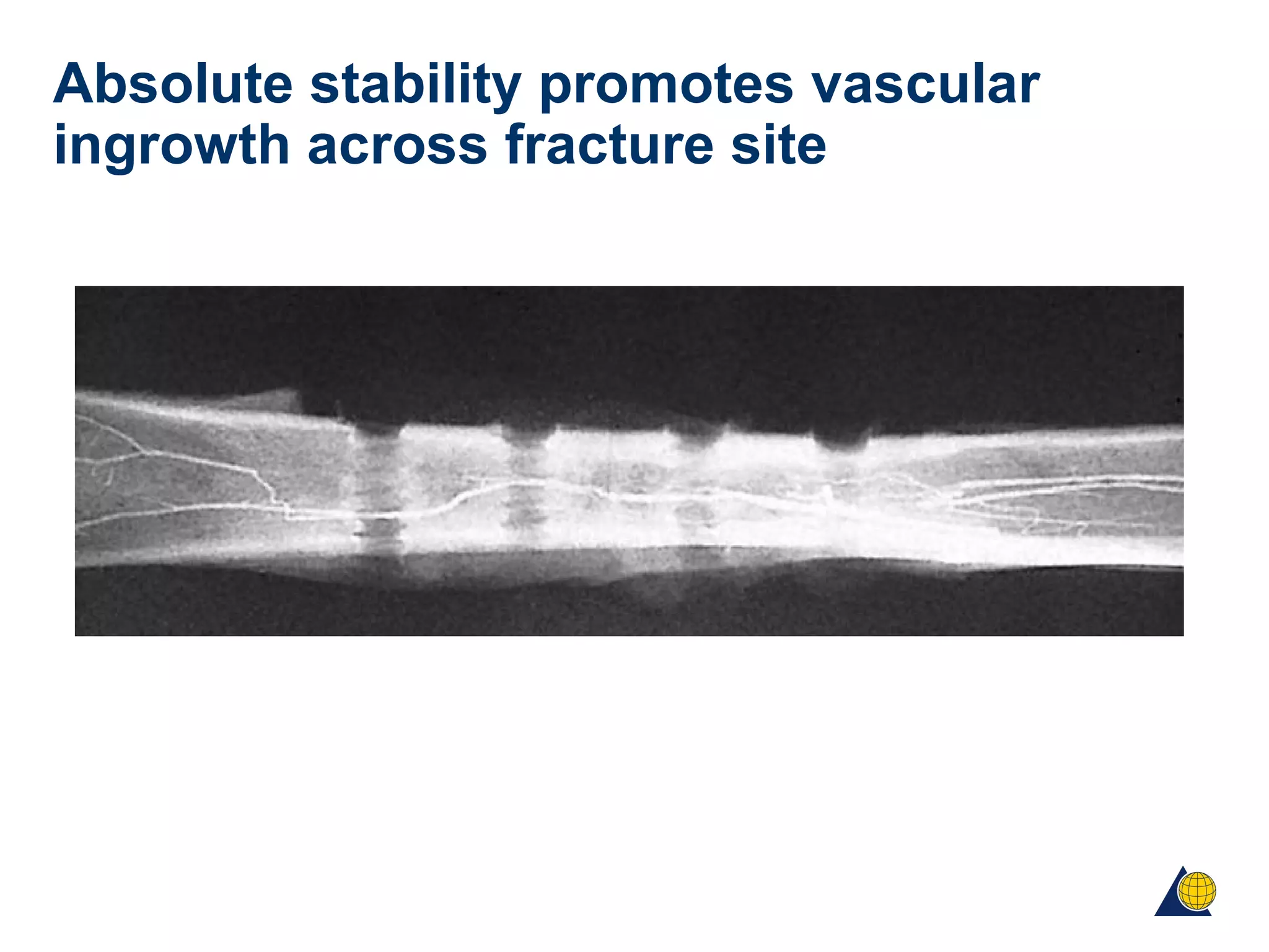Biomechanics and biology of absolute stability | PPT