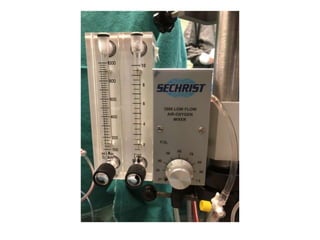 Cpb oxygenators DR NIKUNJ R SHEKHADA (MBBS,MS GEN SURG ,DNB CTS SR) | PPTX