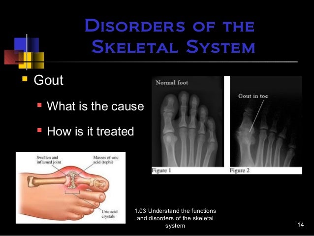 1.03 understand the_functions_and_disorders_of_the_skeletal_system