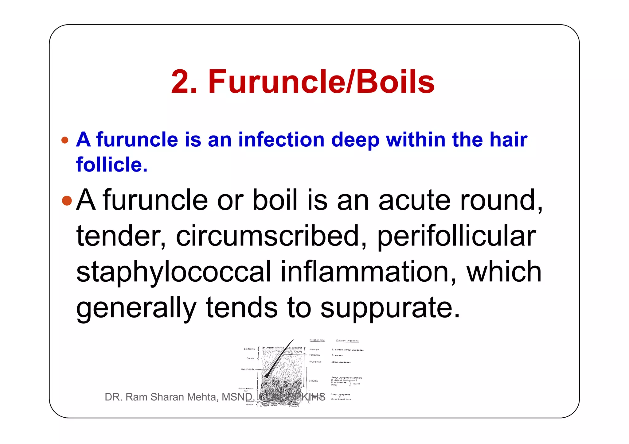 1.1.1. bacterial infection of skin [compatibility mode] | PDF