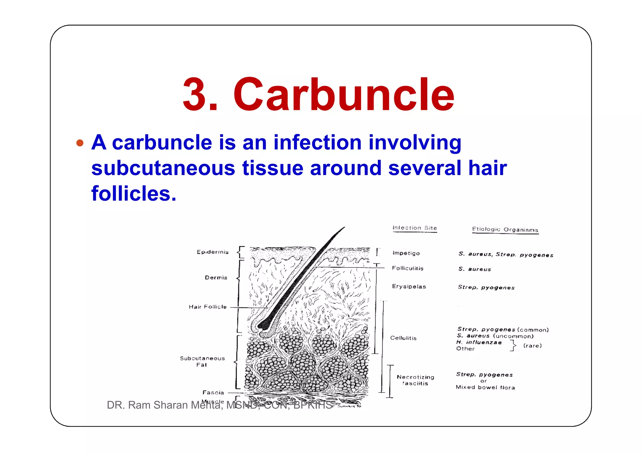 1.1.1. bacterial infection of skin [compatibility mode] | PDF