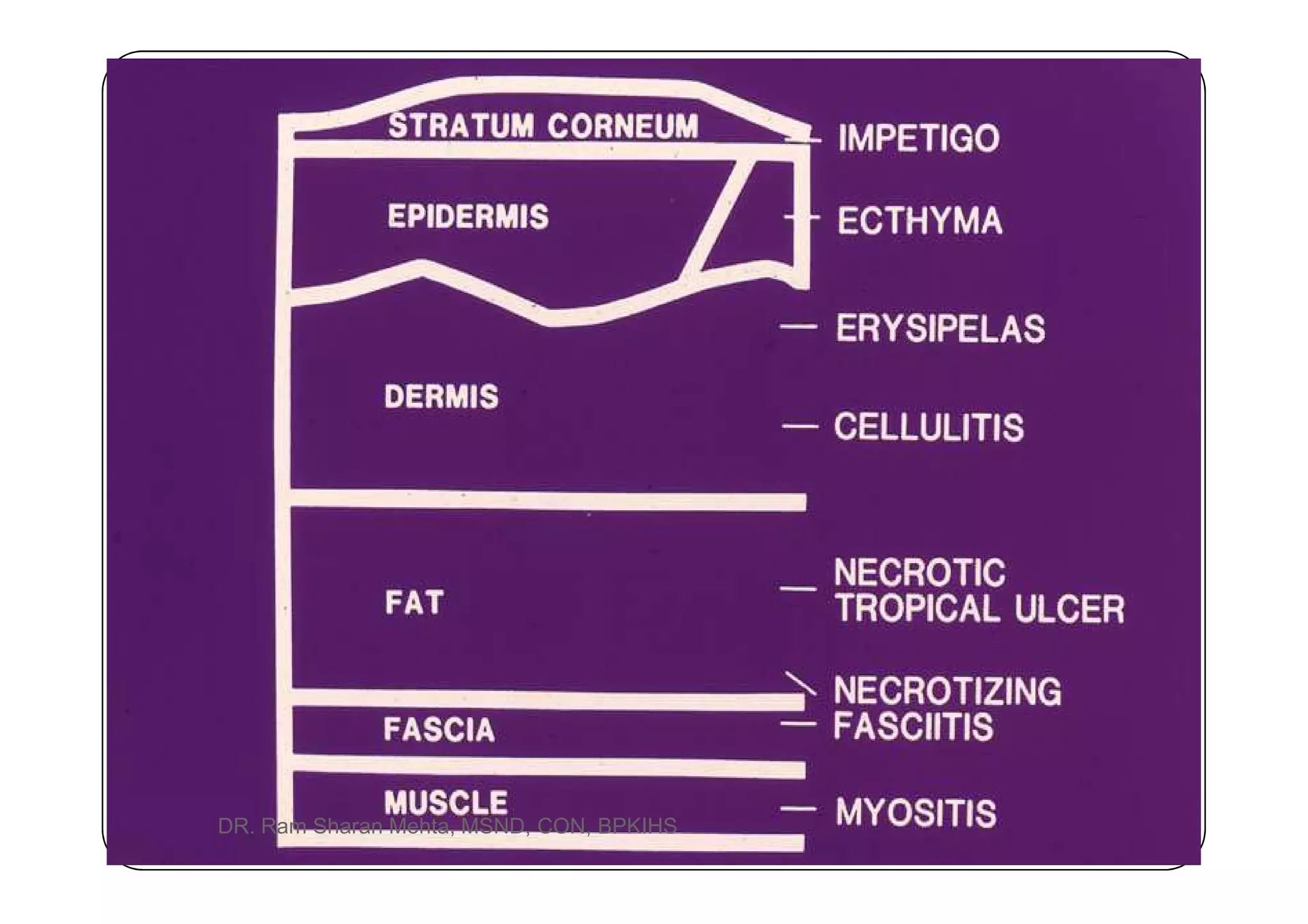 1.1.1. bacterial infection of skin [compatibility mode] | PDF