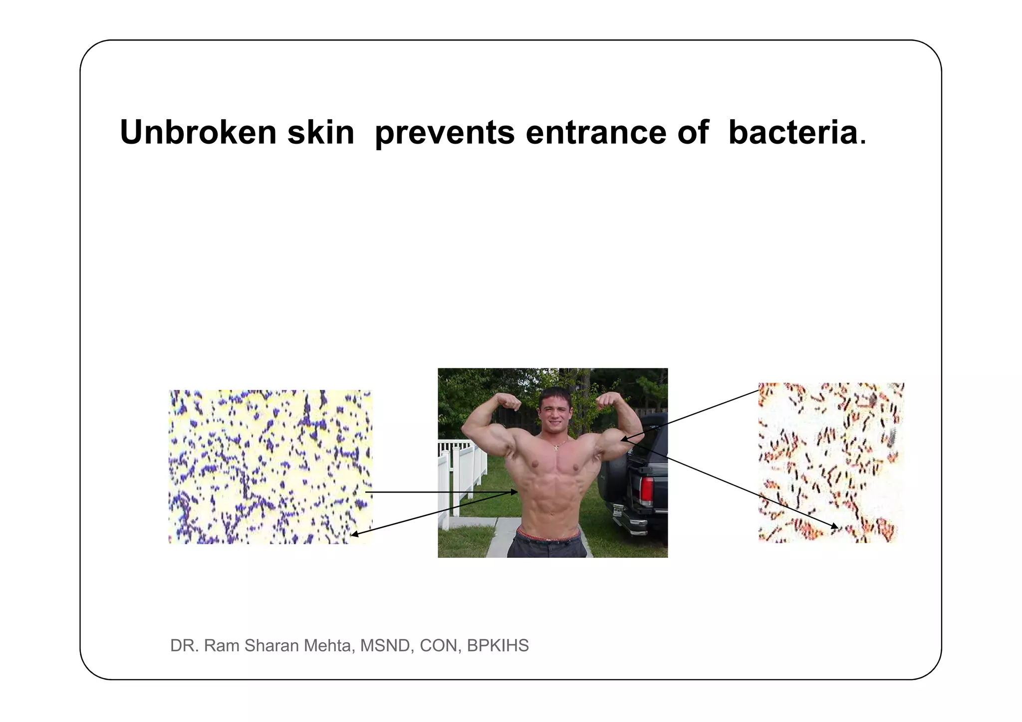 1.1.1. bacterial infection of skin [compatibility mode] | PDF