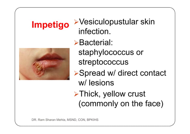 1.1.1. bacterial infection of skin [compatibility mode] | PDF | Skin ...