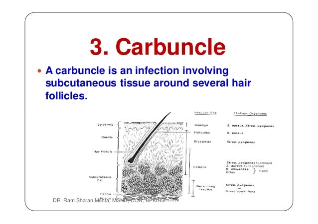 1.1.1. bacterial infection of skin [compatibility mode]